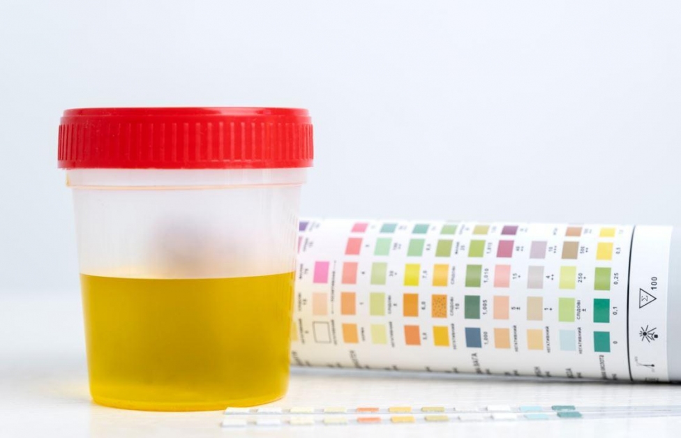 Come stanno i tuoi reni? La risposta nella tua pipì | News ...